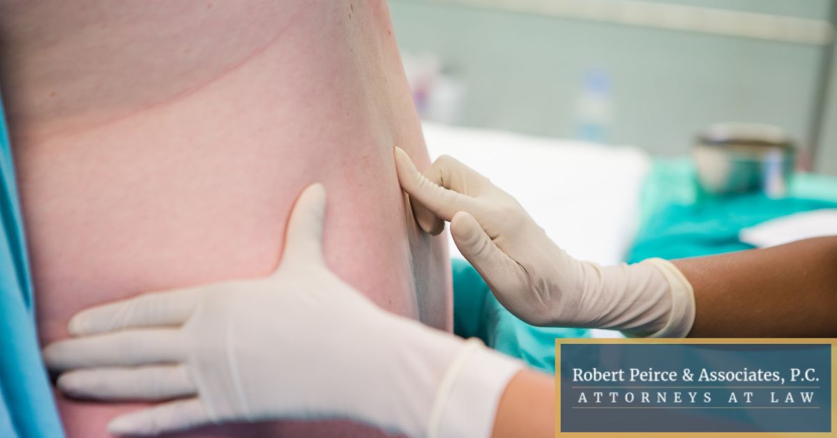 Epidural and Anesthesia Errors: What Expecting Mothers Need to Know